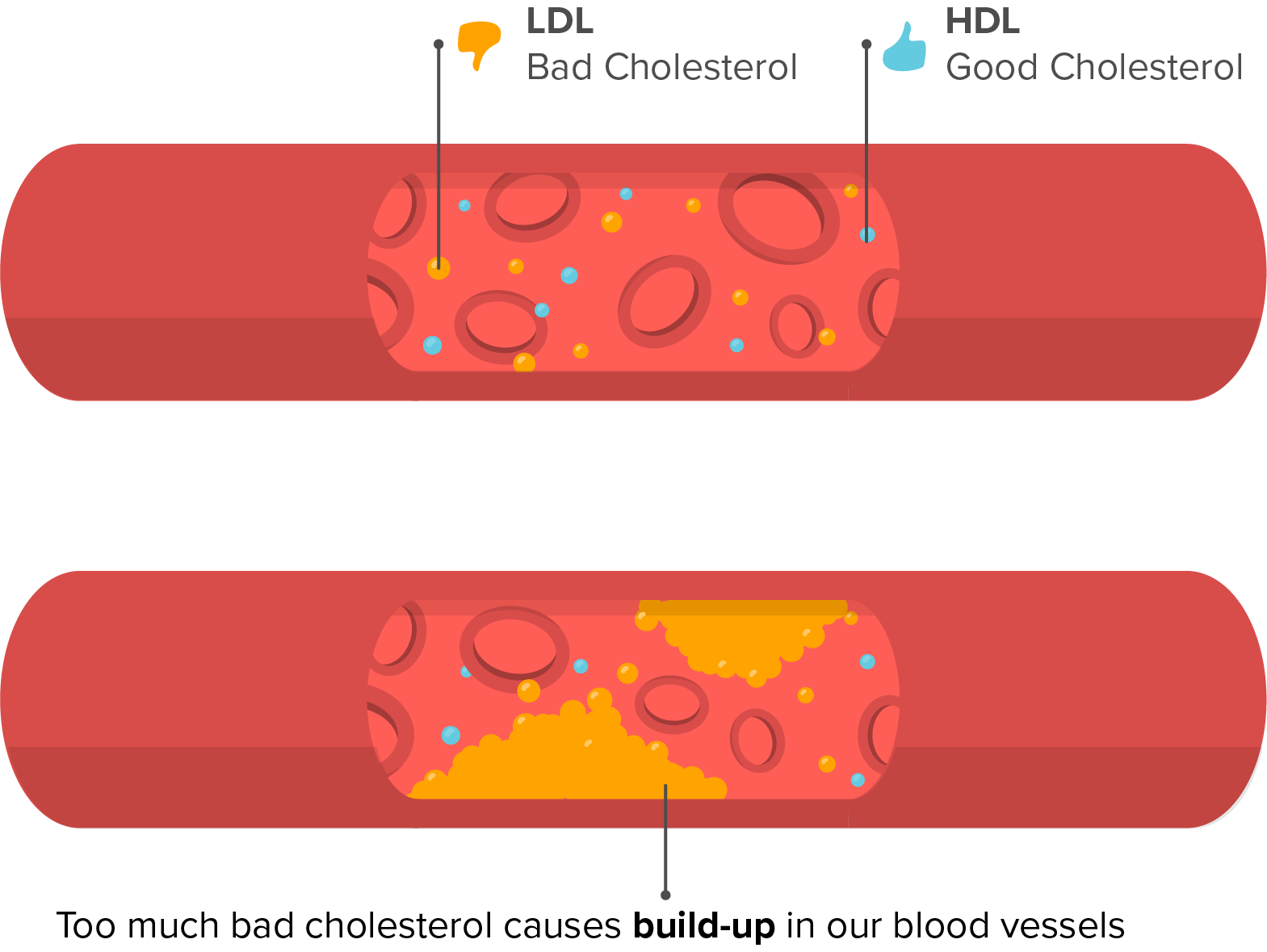 Understanding Cholesterol - Let's Talk Cholesterol