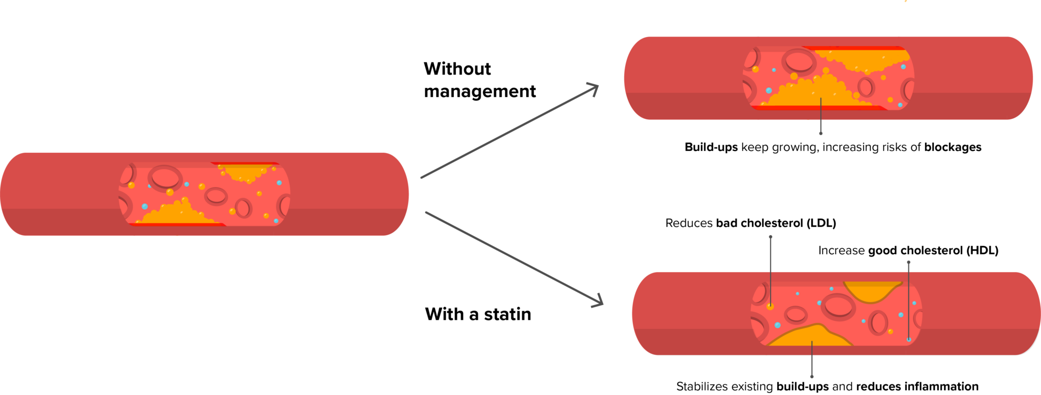 Understanding Cholesterol - Let's Talk Cholesterol