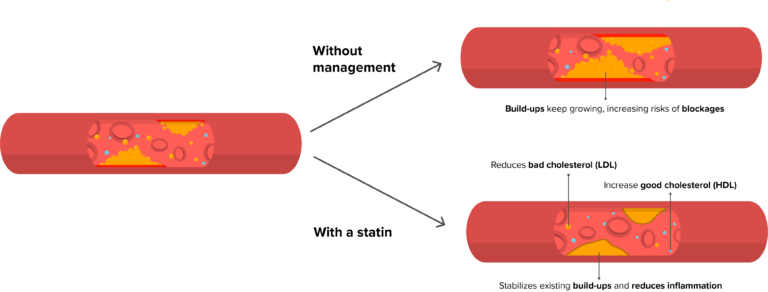 Understanding Cholesterol - Let's Talk Cholesterol